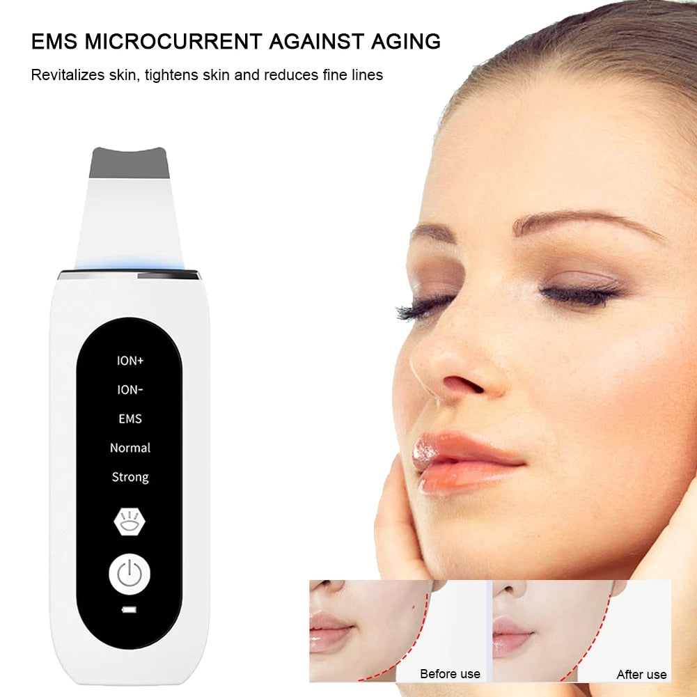 Ultrasonic Skin Scrubber with 5 Modes Skin Exfoliator Scraper – majexic ...